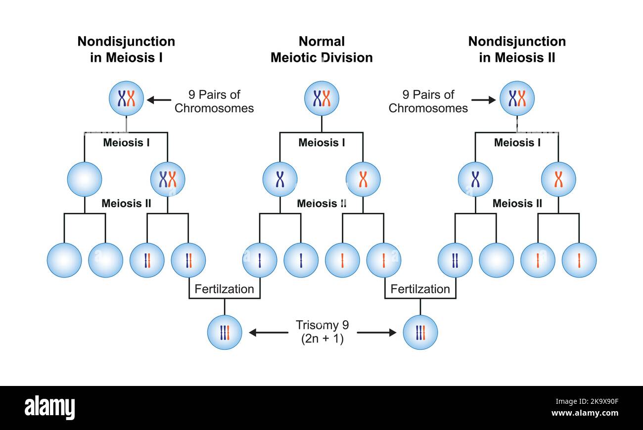 Scientific Designing of Nondisjunction in Trisomy 9. Colorful Symbols ...