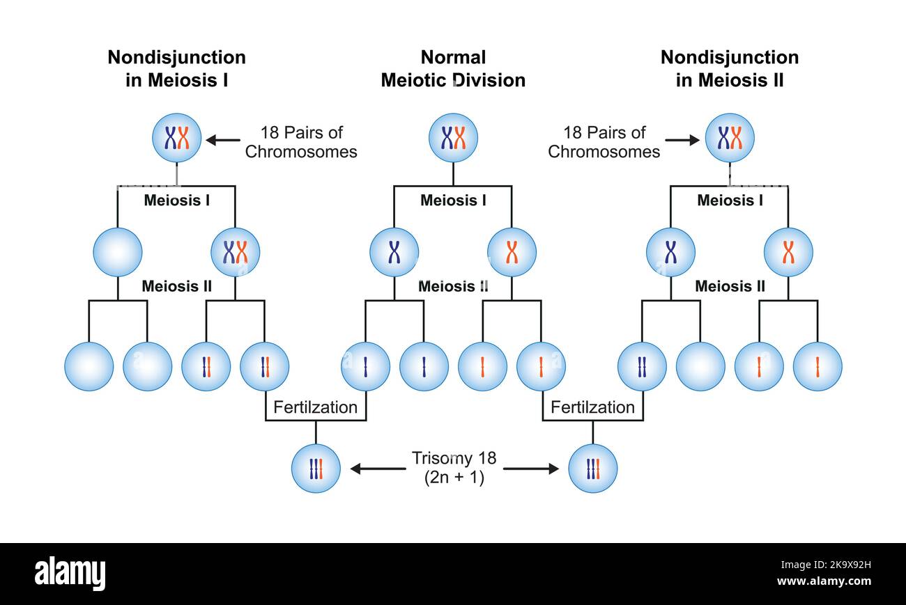 Scientific Designing of Nondisjunction in Trisomy 18. Colorful Symbols ... Scientific Designing of Nondisjunction in Trisomy 18. Colorful Symbols ...