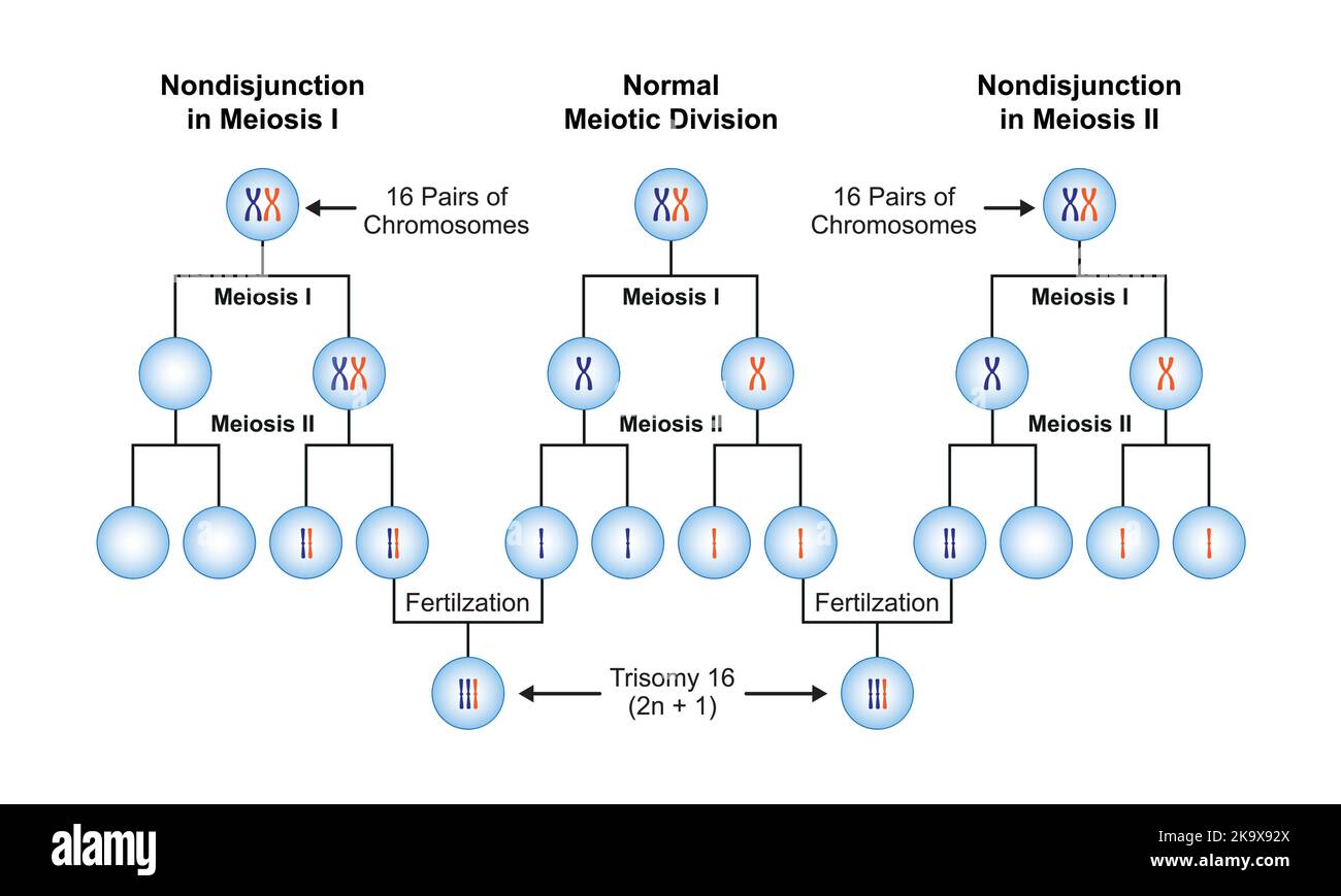 Scientific Designing Of Nondisjunction In Trisomy 16 Colorful Symbols
