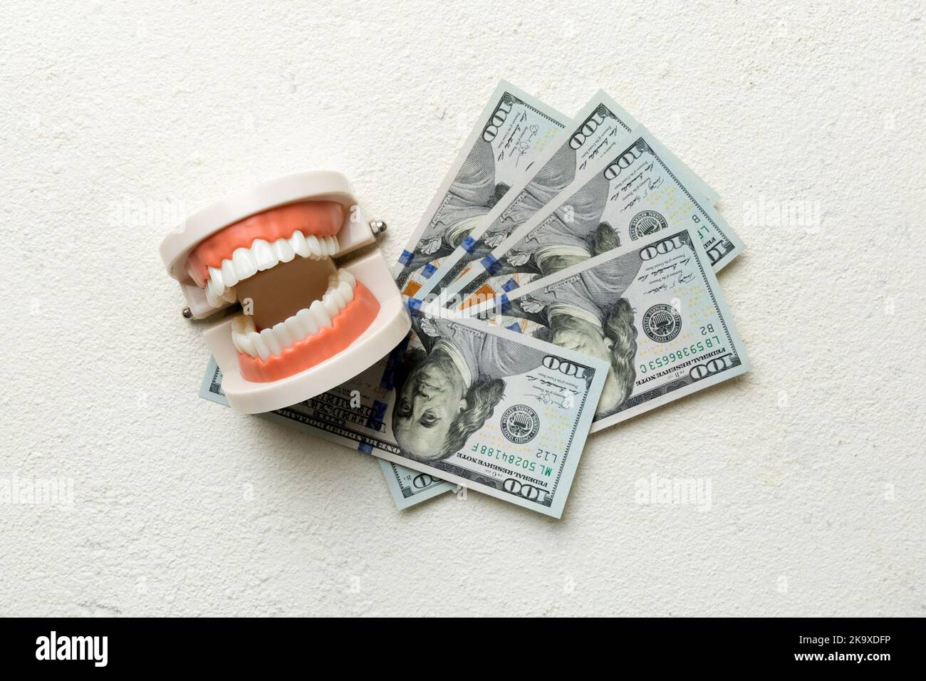 Closeup model of a human jaw with white teeth and dollar bill ...