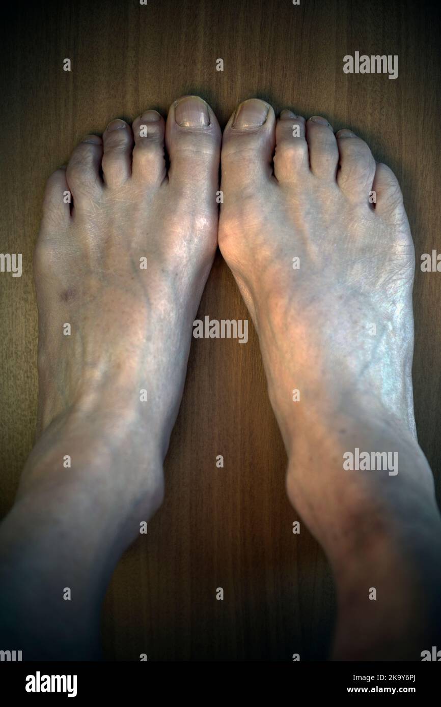 Old mans feet hi-res stock photography and images - Alamy