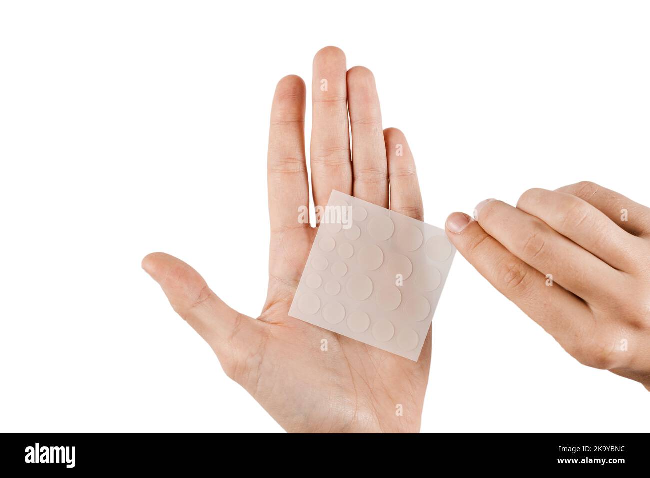 Rosacea On Hands