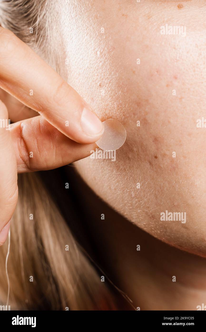 Woman problematic skin using face hi-res stock photography and images ...