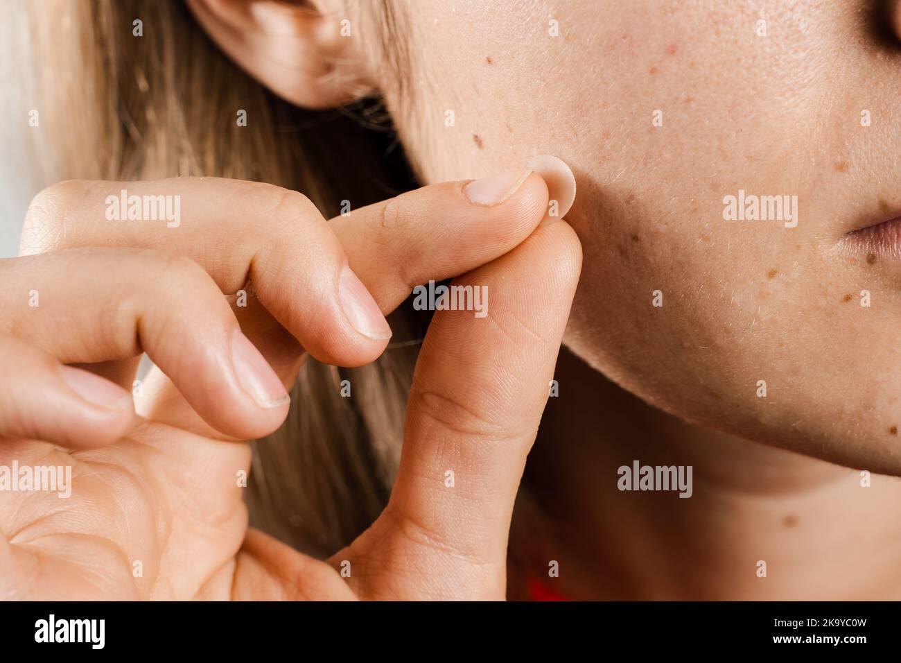 Woman problematic skin using face hi-res stock photography and images ...