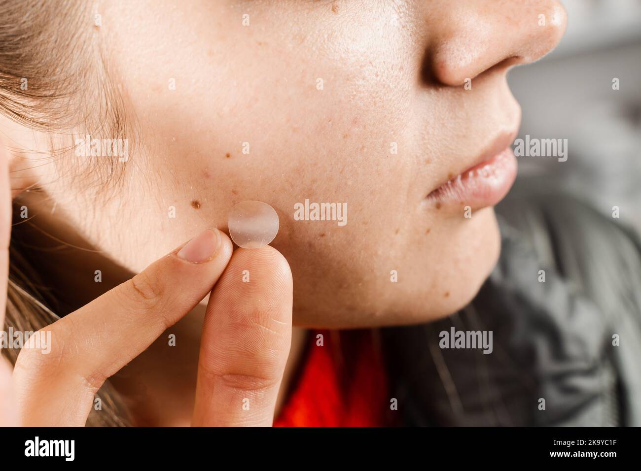 Woman problematic skin using face hi-res stock photography and images ...