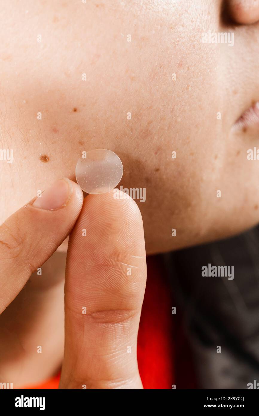 Woman problematic skin using face hi-res stock photography and images ...