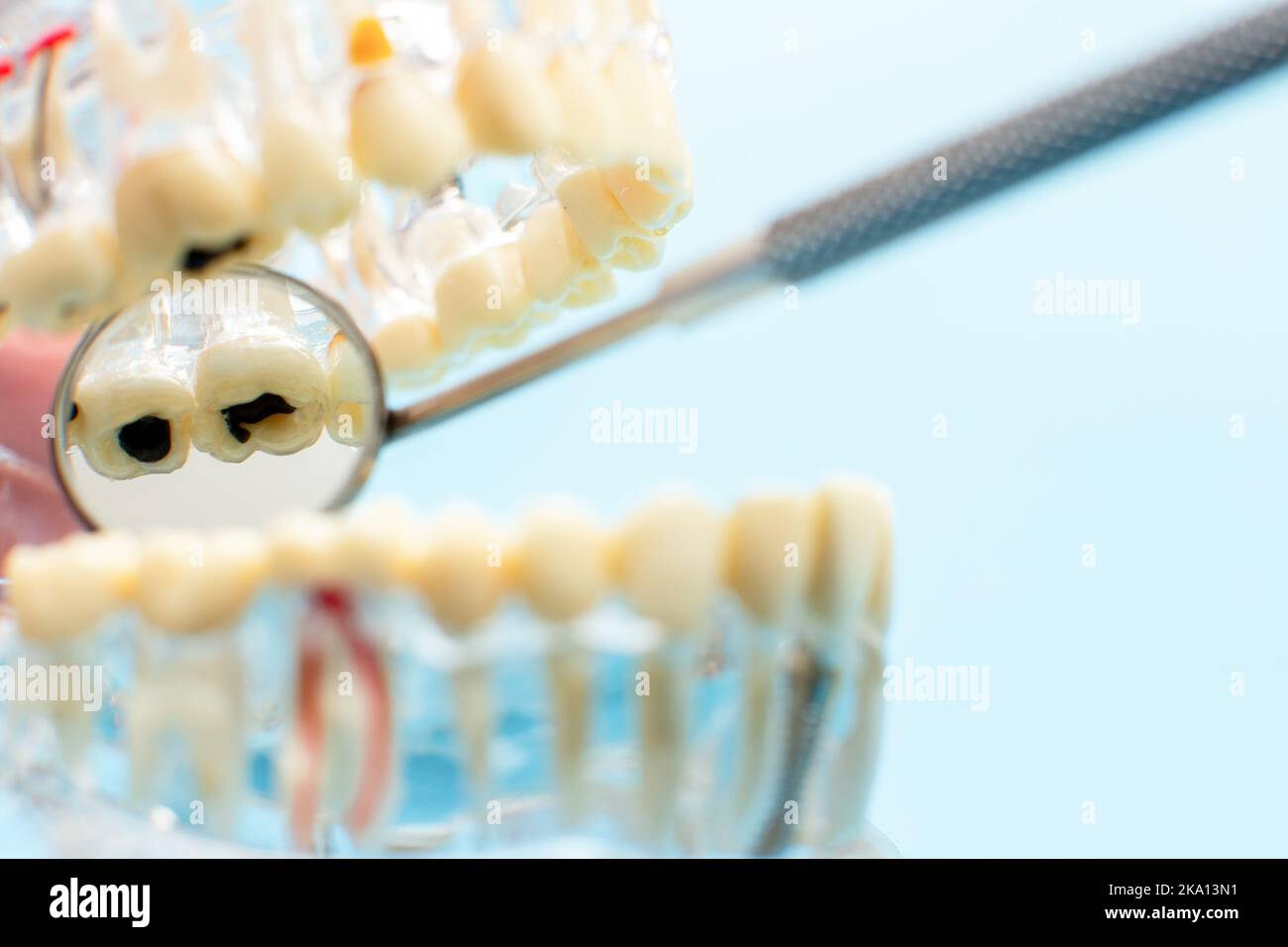 Tooth model metal wire hi-res stock photography and images - Alamy