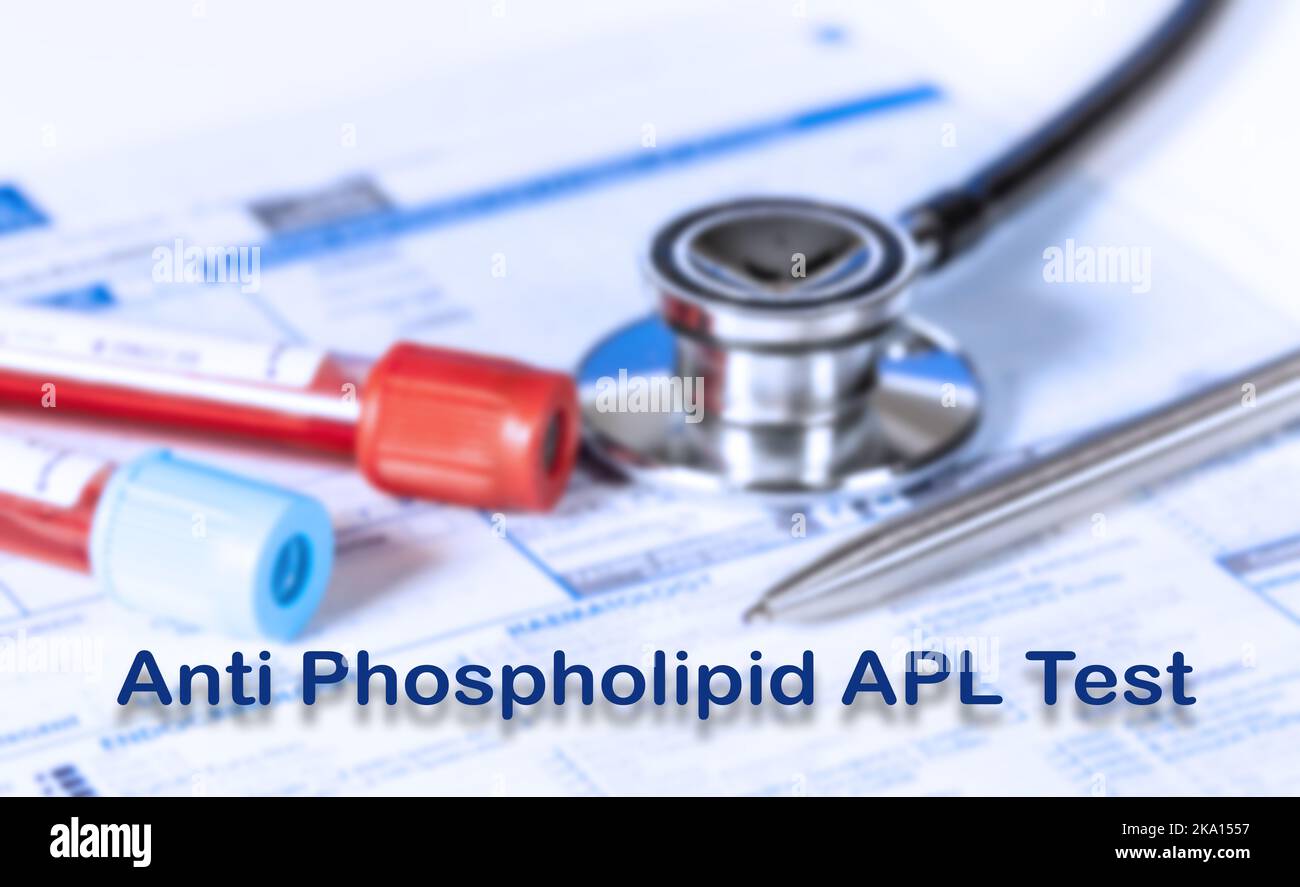 Anti Phospholipid APL Test Testing Medical Concept. Checkup list ...