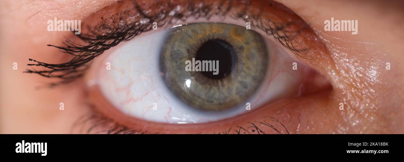 Green eyelid hi-res stock photography and images - Alamy