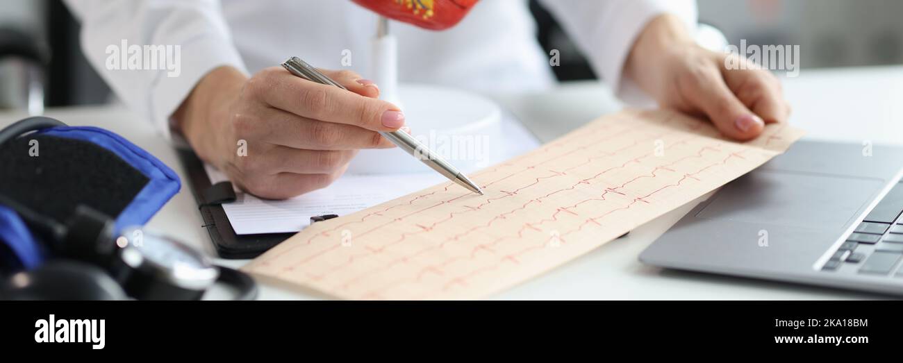 Doctor cardiologist examines electrocardiogram of patient heart in ...