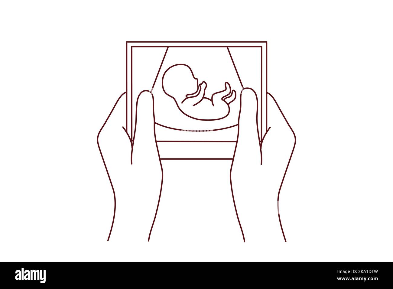 Hands of person holding scan of embryo waiting for baby birth. Future ...