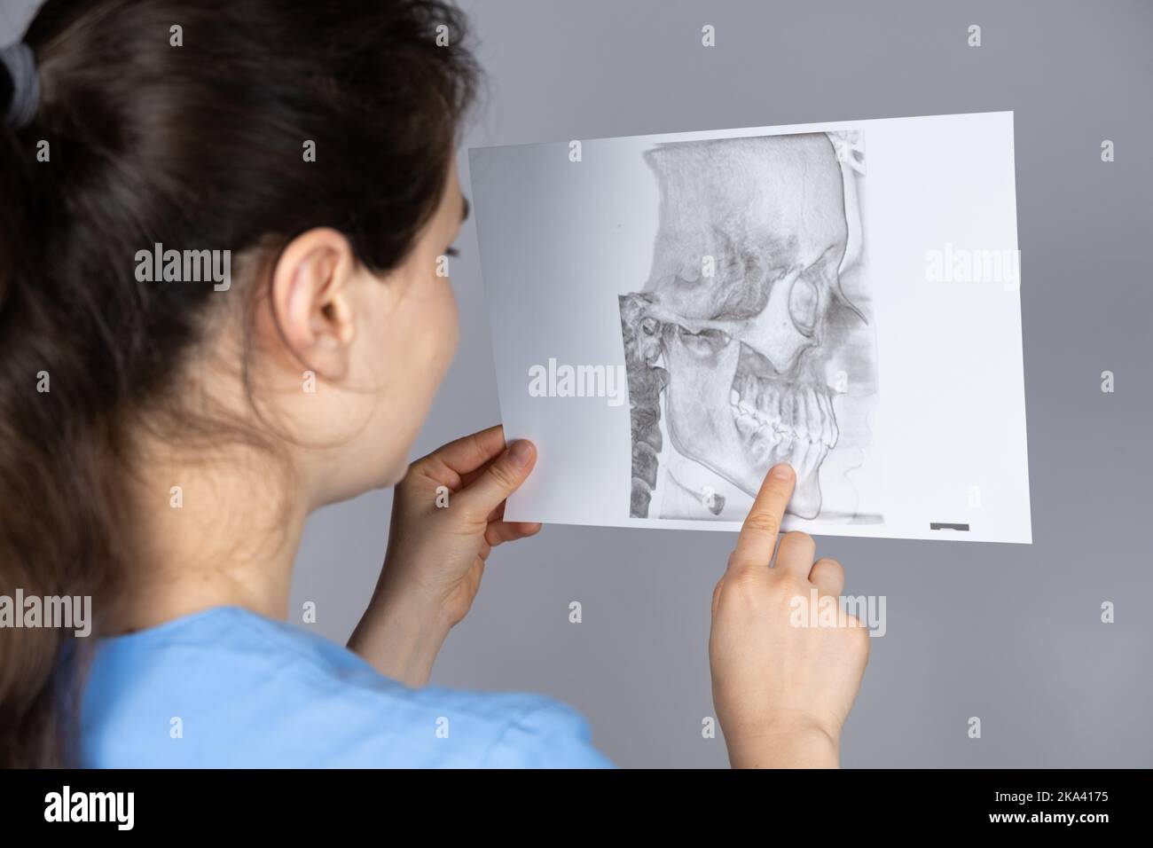 Temporomandibular joint hi-res stock photography and images - Alamy