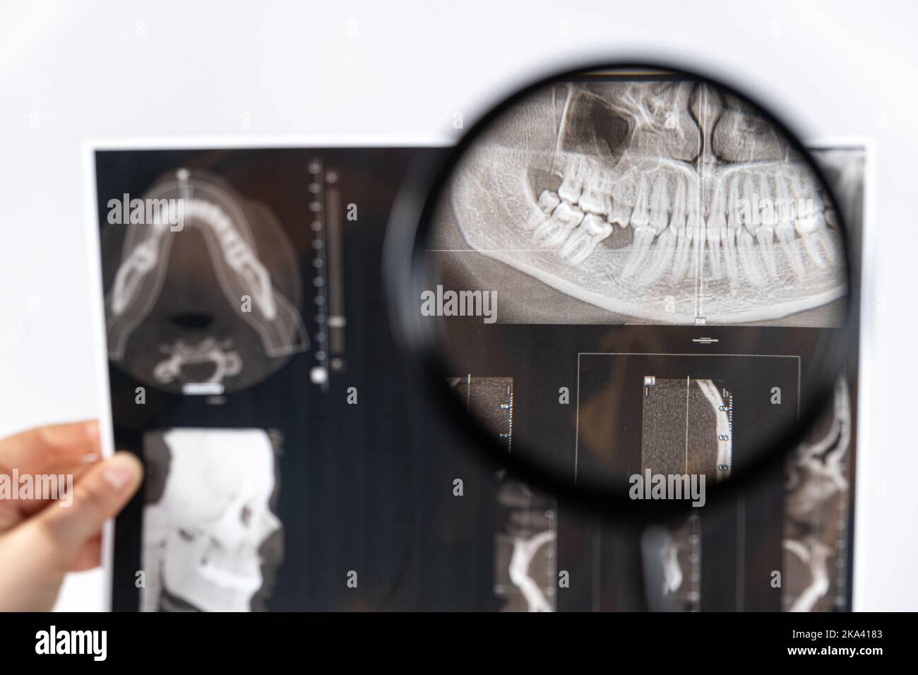 The doctor holds a CT scan of a patient with temporomandibular joint ...