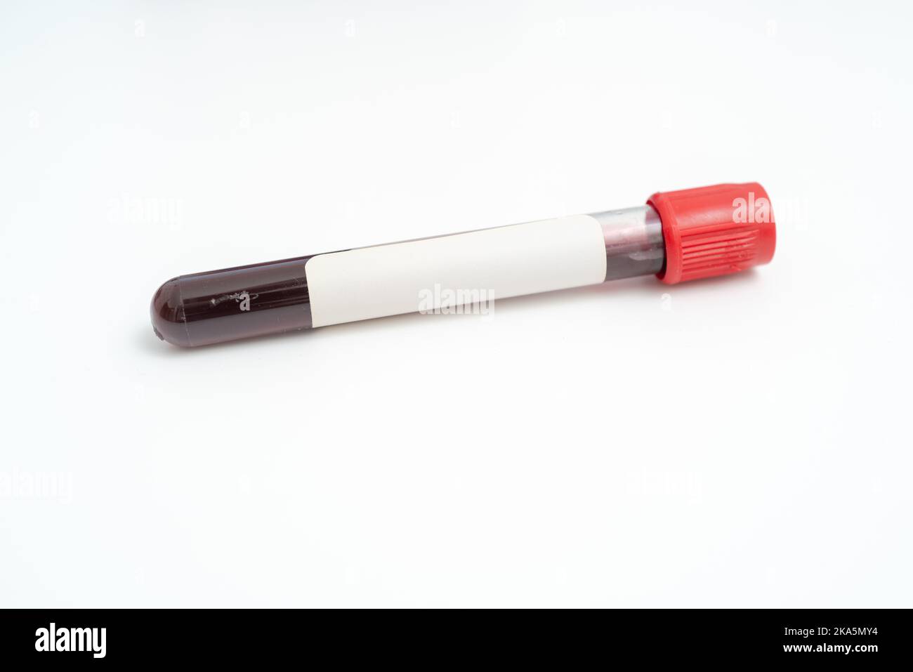 Test tube with empty label to biological sample for medical laboratory ...