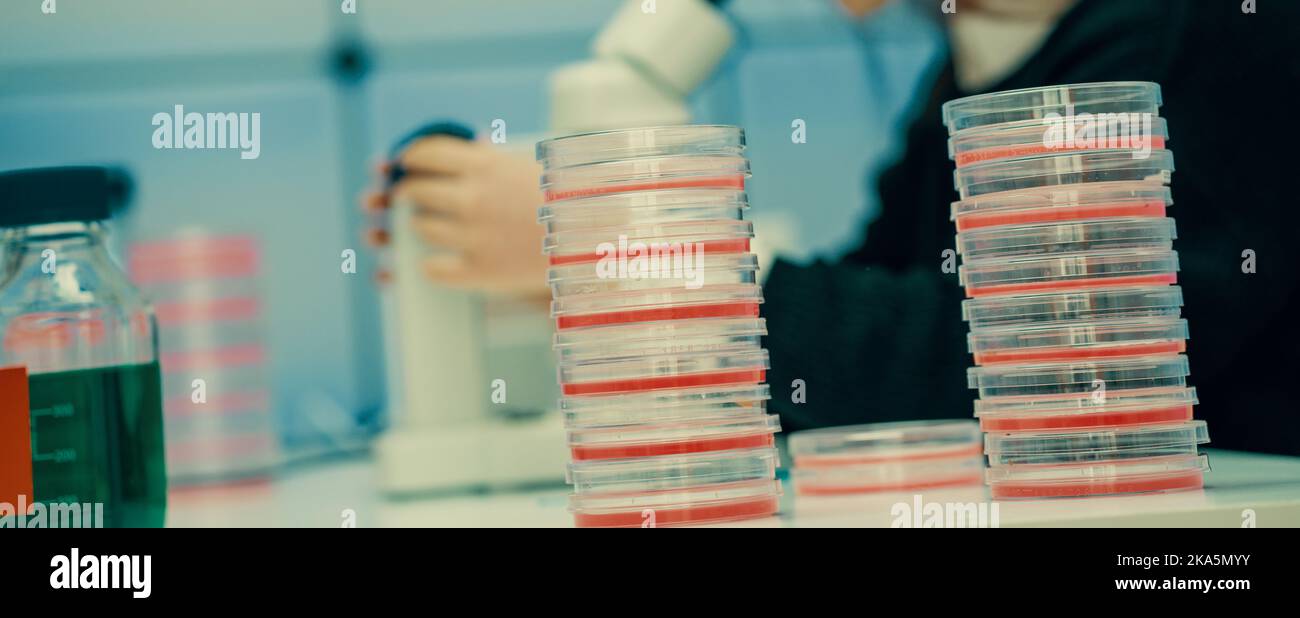 Study of Petri dishes with biological cultures in a microbiological ...