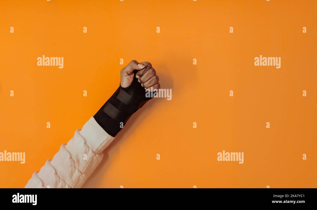 isolated hurt hand of afro girl on yellow background Stock Photo - Alamy