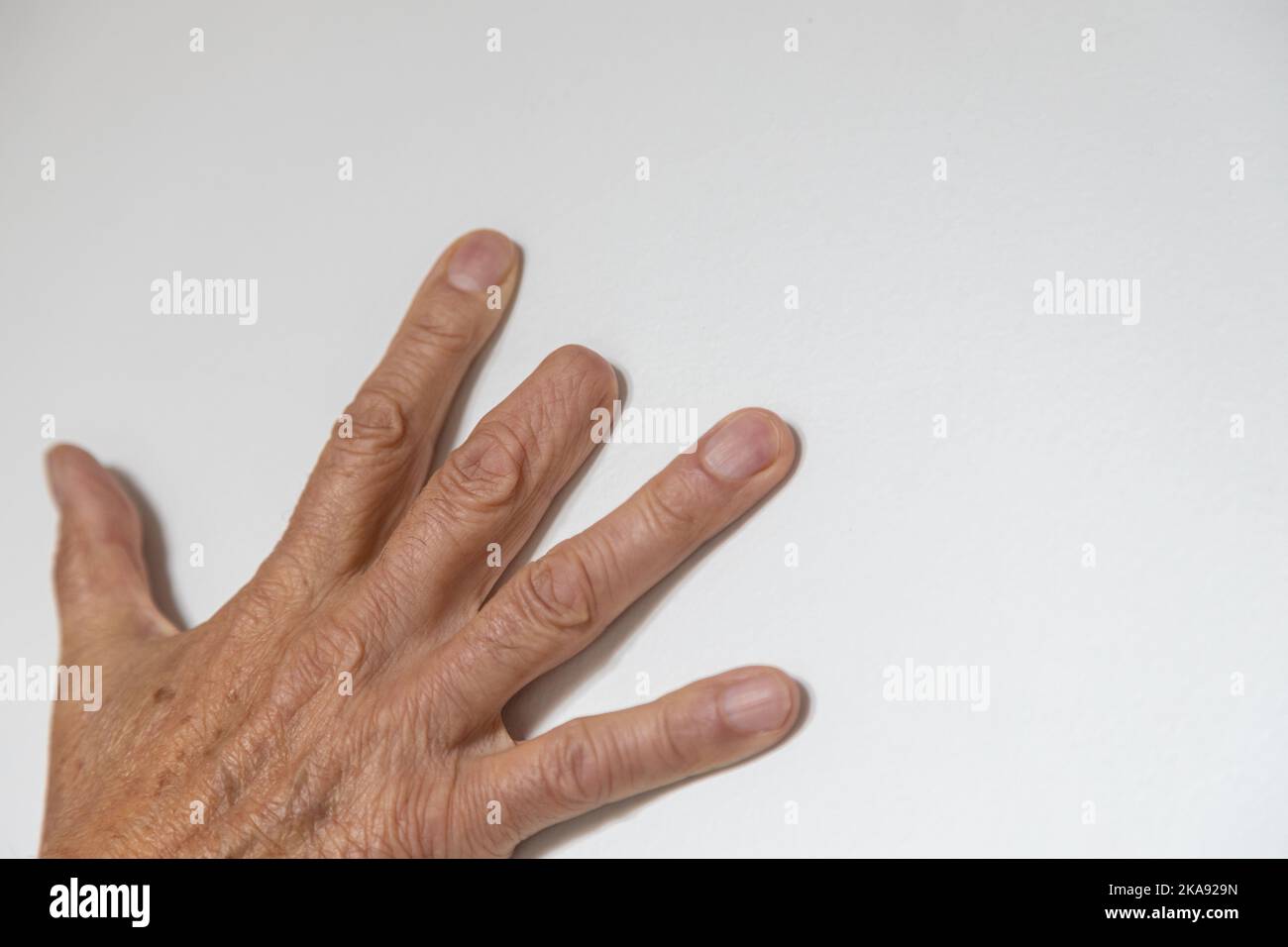 Arm amputation veteran hi-res stock photography and images - Alamy