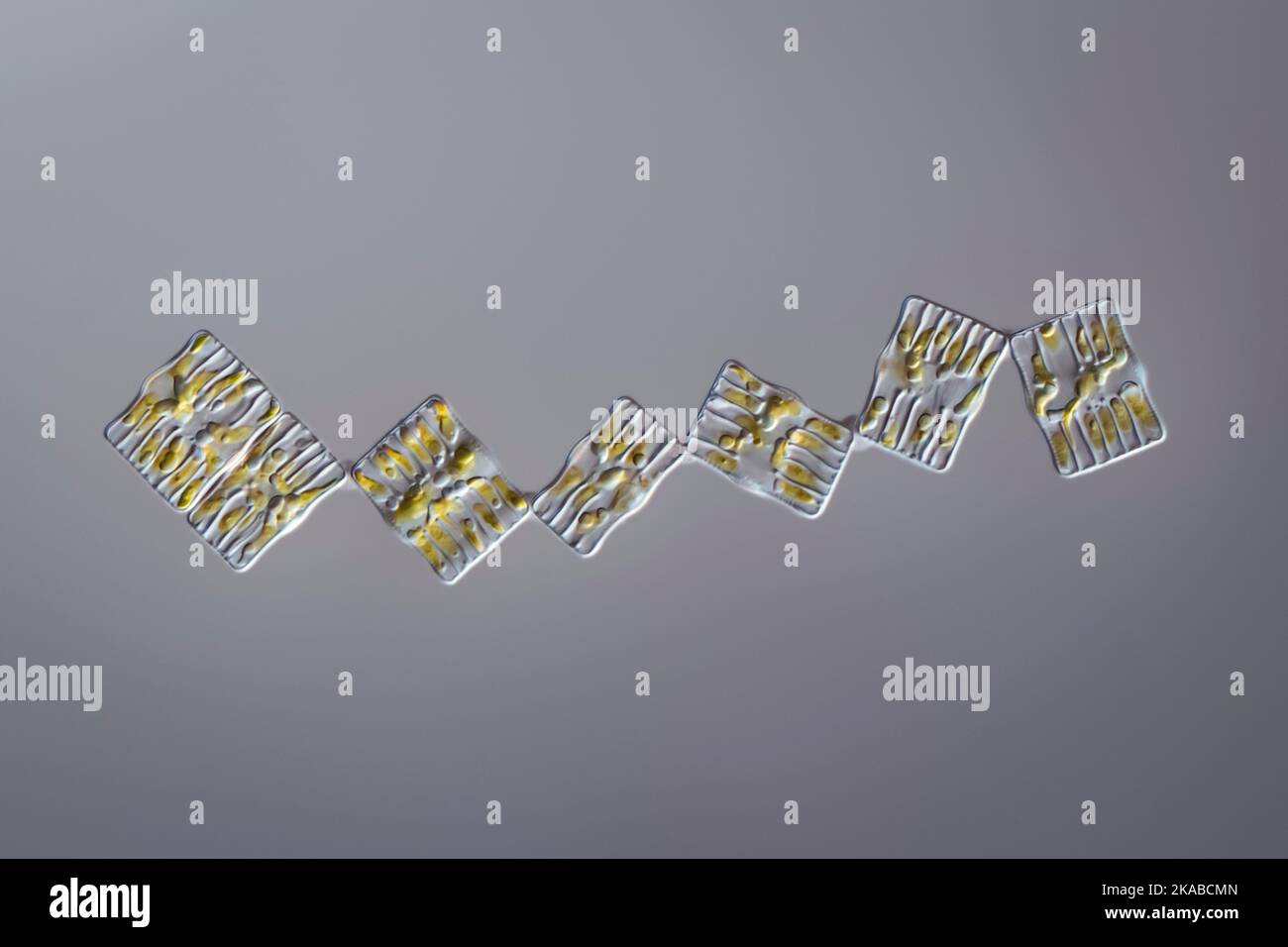 Tabellaria flocculosa diatom, light micrograph Stock Photo - Alamy