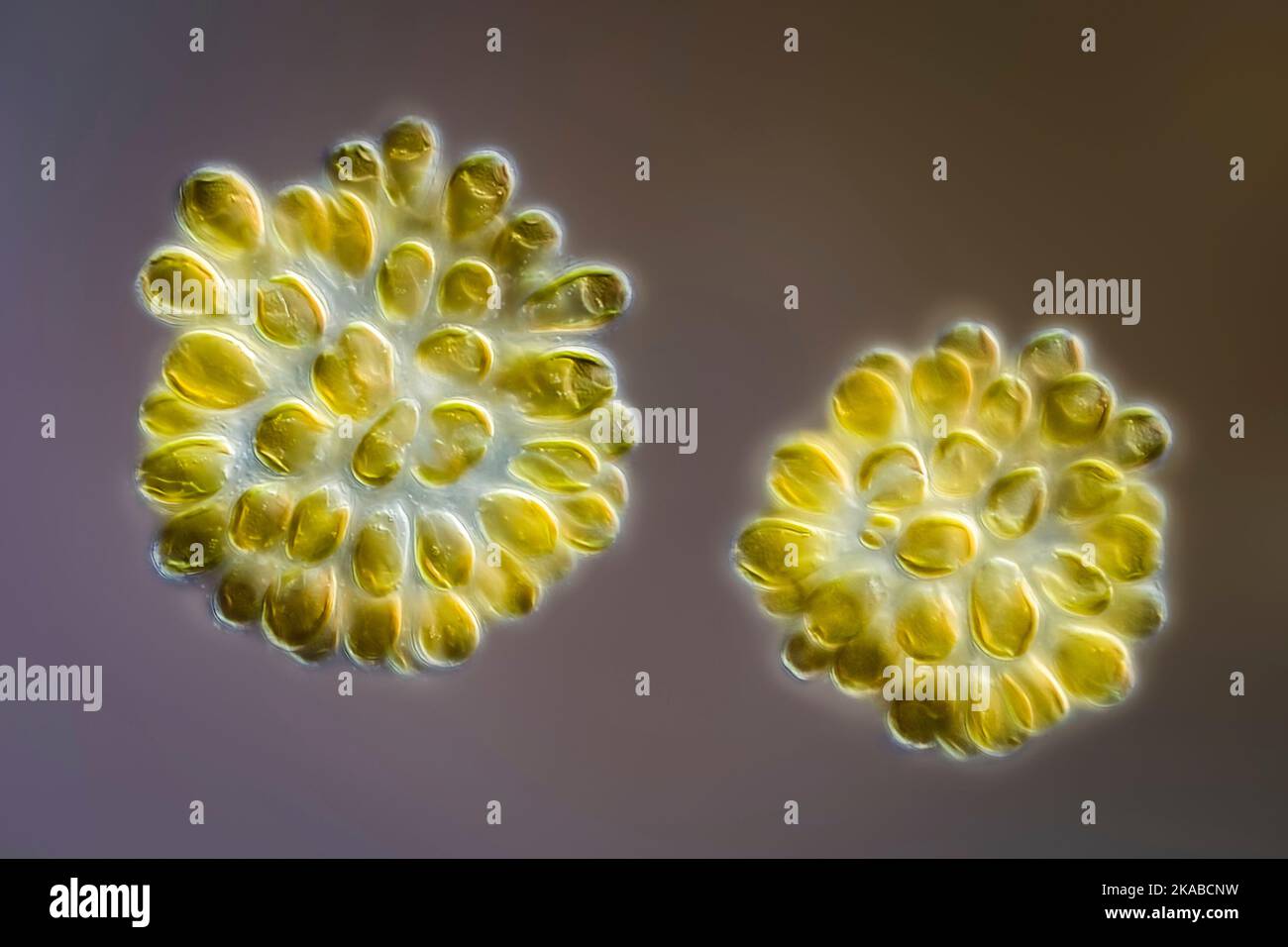 Golden algae, light micrograph Stock Photo - Alamy