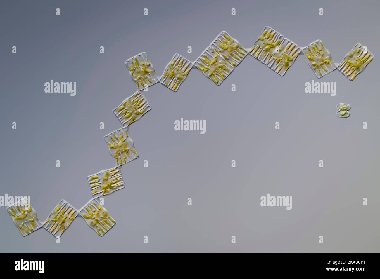 Tabellaria flocculosa diatom, light micrograph Stock Photo - Alamy