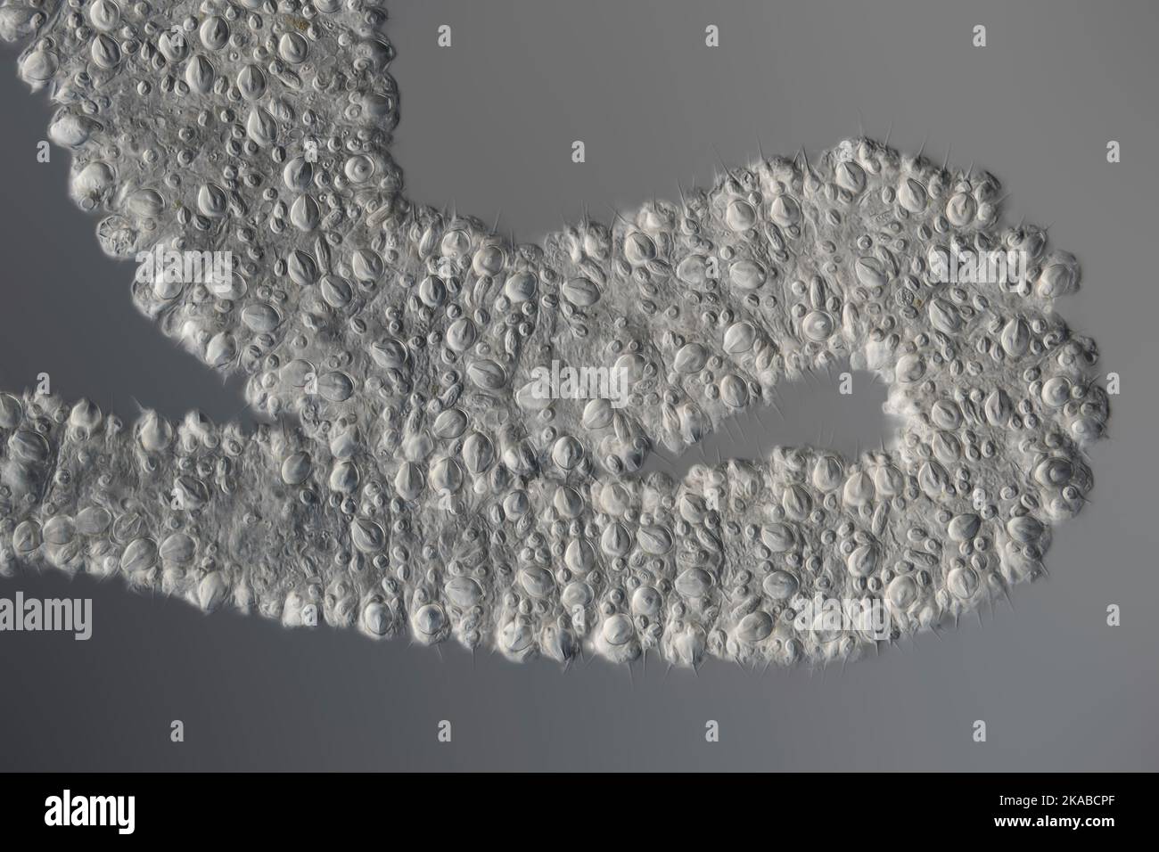 Hydra tentacle, light micrograph Stock Photo - Alamy