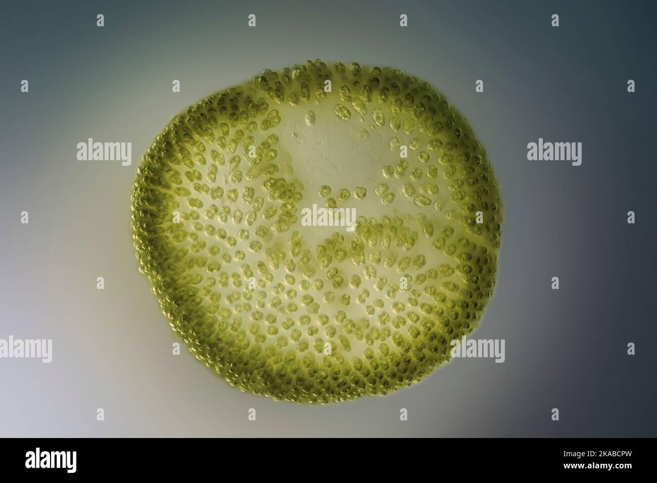 Golden algae, light micrograph Stock Photo - Alamy