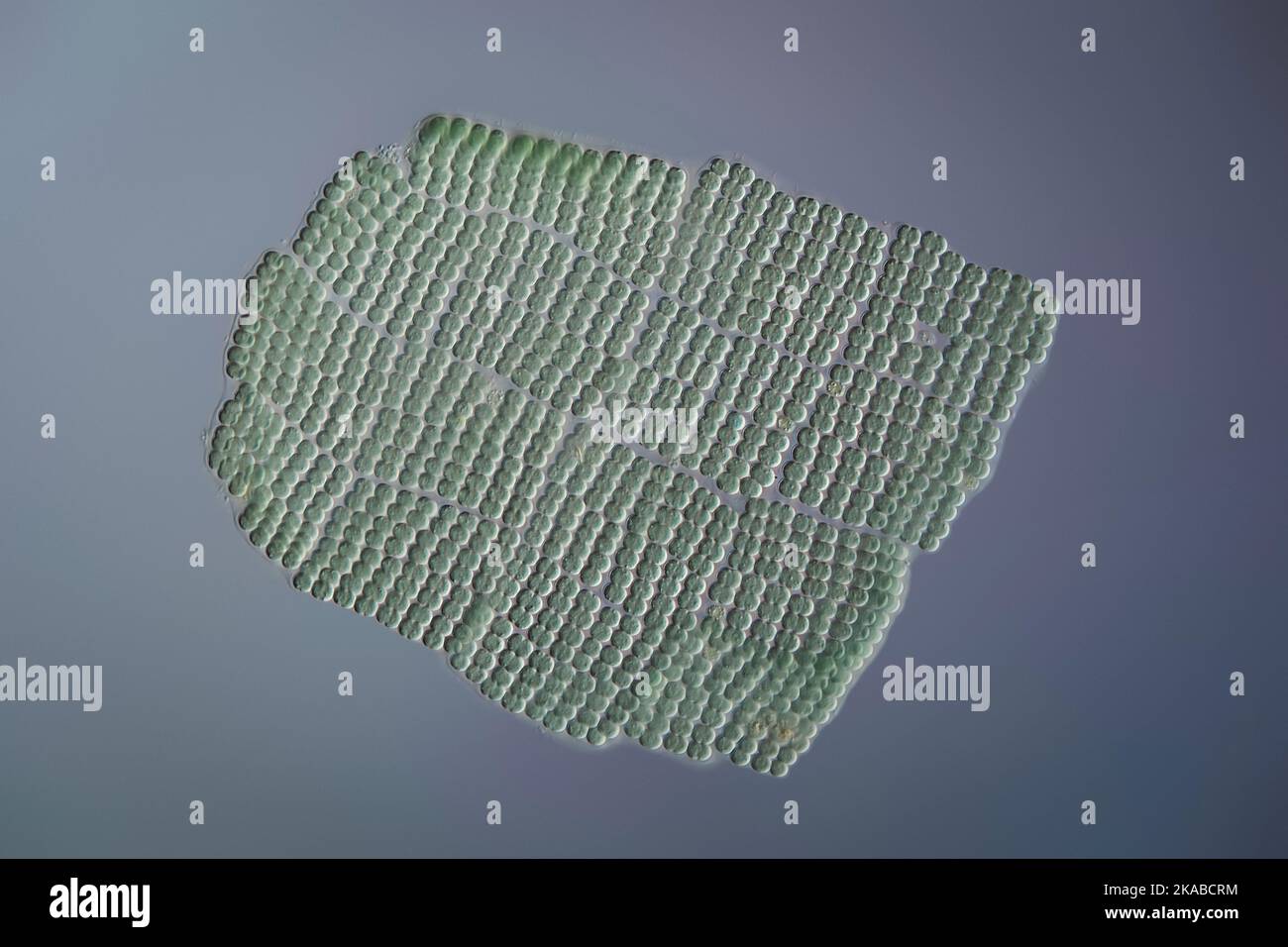 Merismopedia sp. cyanobacteria, light micrograph Stock Photo - Alamy