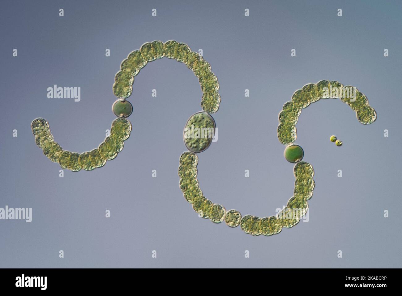 Anabaena sp. cyanobacteria, light micrograph Stock Photo - Alamy