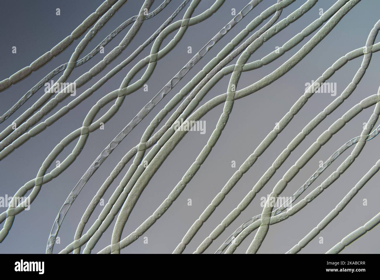 Gloeotrichia sp. cyanobacteria, light micrograph Stock Photo - Alamy