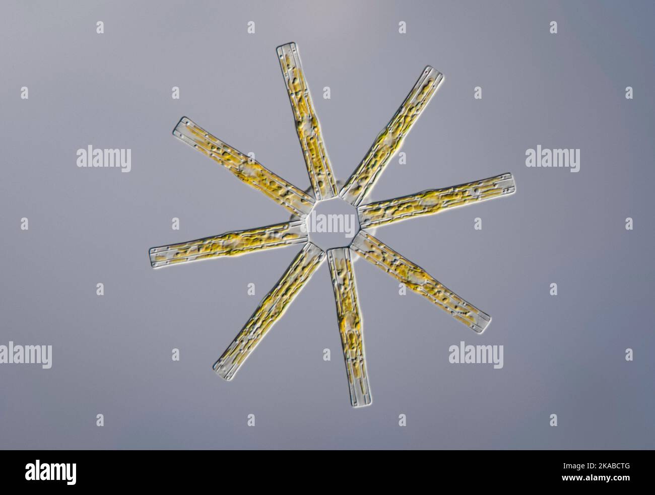 Tabellaria fenestrata , light micrograph Stock Photo - Alamy