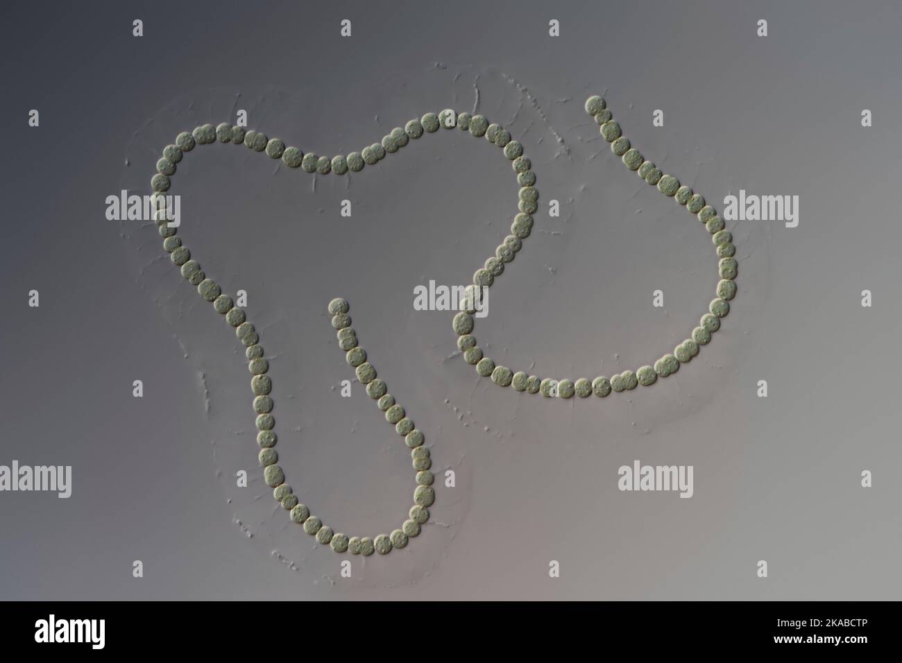 Nostoc flagelliforme cyanobacteria, light micrograph Stock Photo - Alamy
