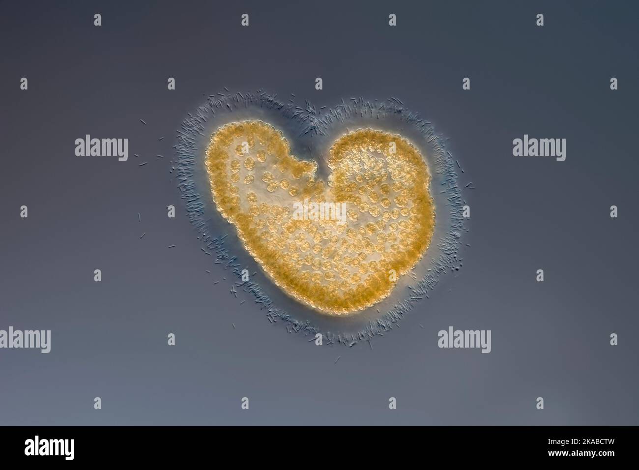 Microcystis sp. cyanobacteria, light micrograph Stock Photo - Alamy