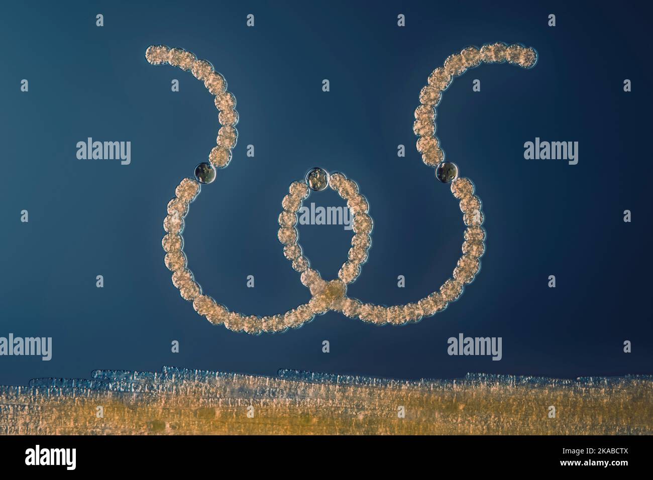 Cyanobacteria , light micrograph Stock Photo - Alamy