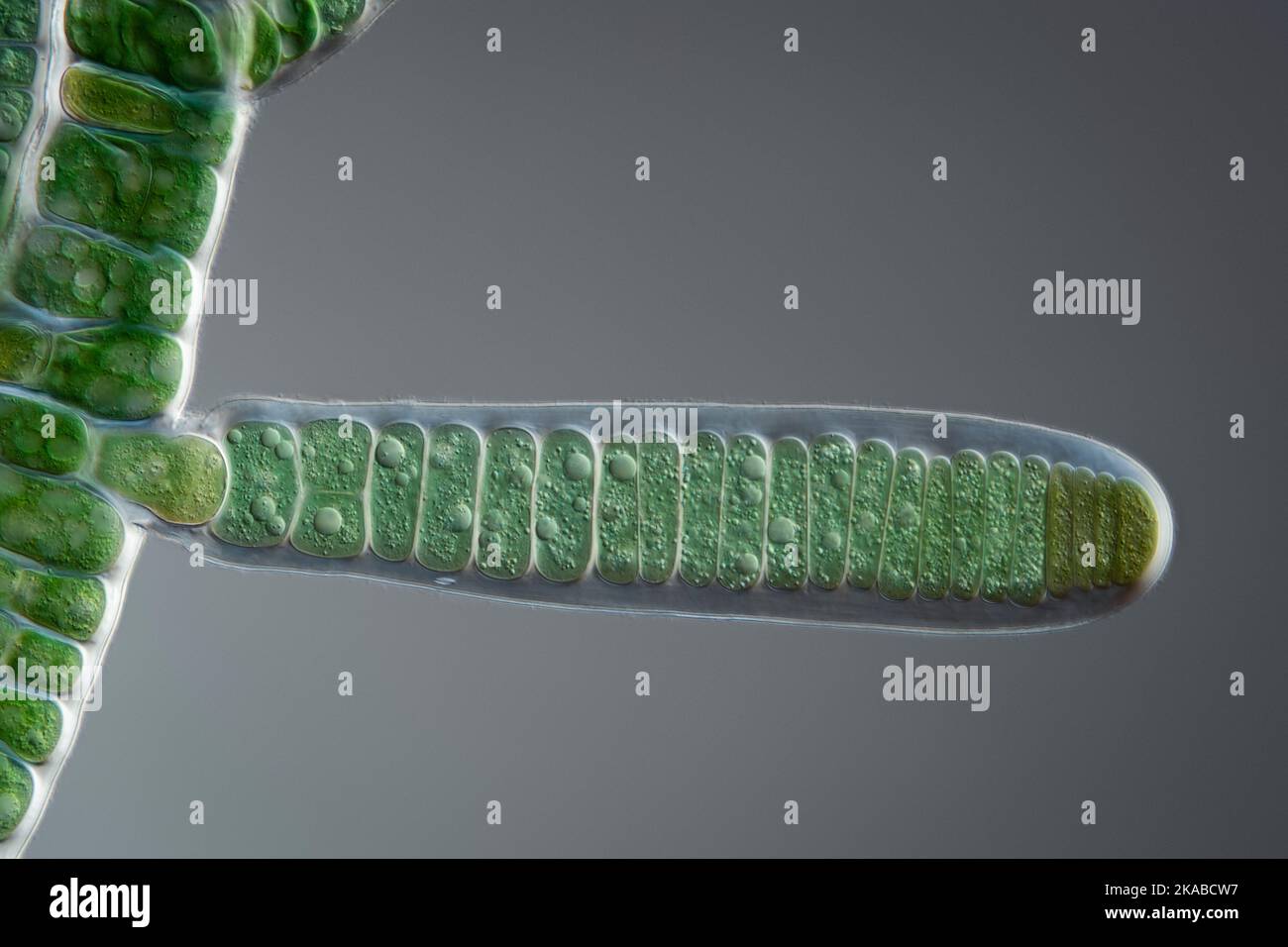 Stigonema mammilosum cyanobacteria, light micrograph Stock Photo - Alamy