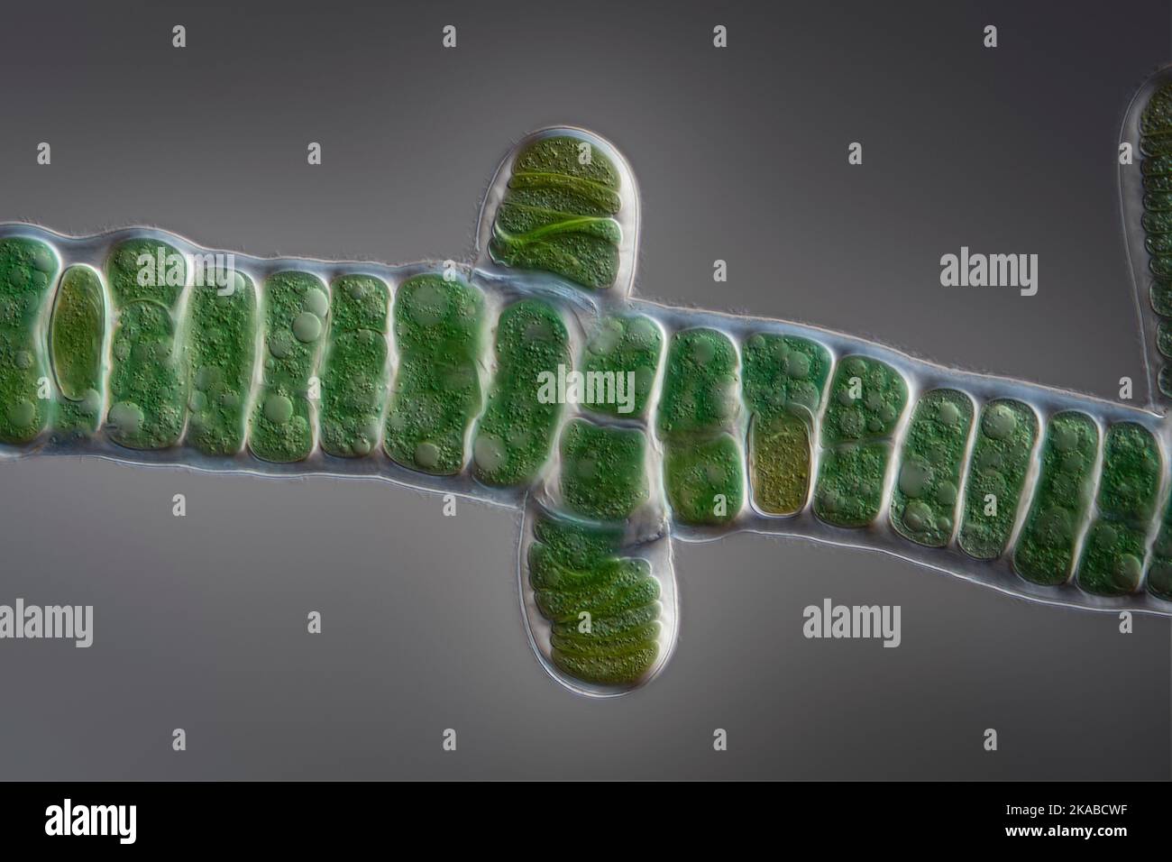 Stigonema mammilosum cyanobacteria, light micrograph Stock Photo - Alamy