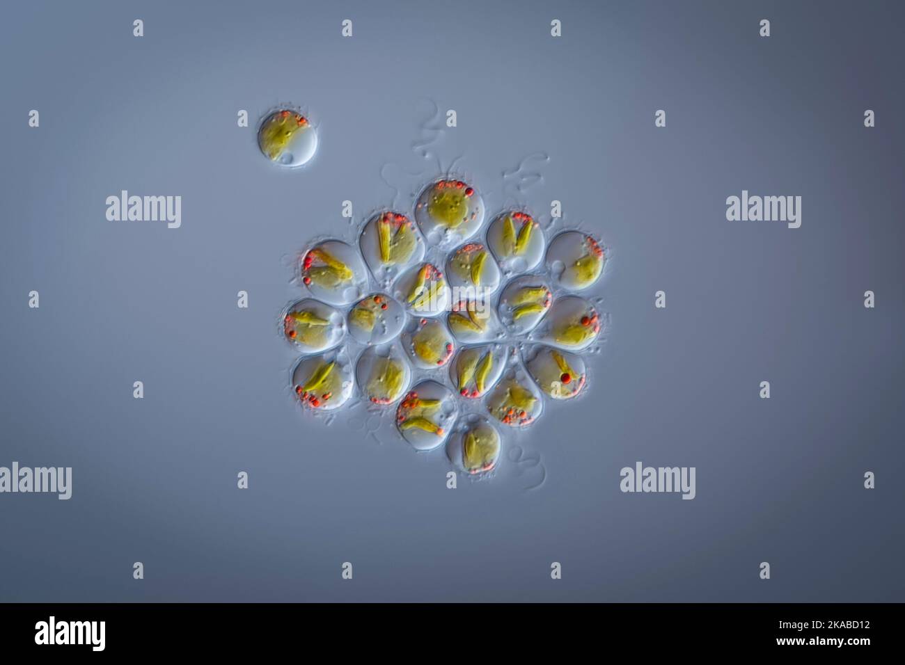 Golden algae, light micrograph Stock Photo - Alamy