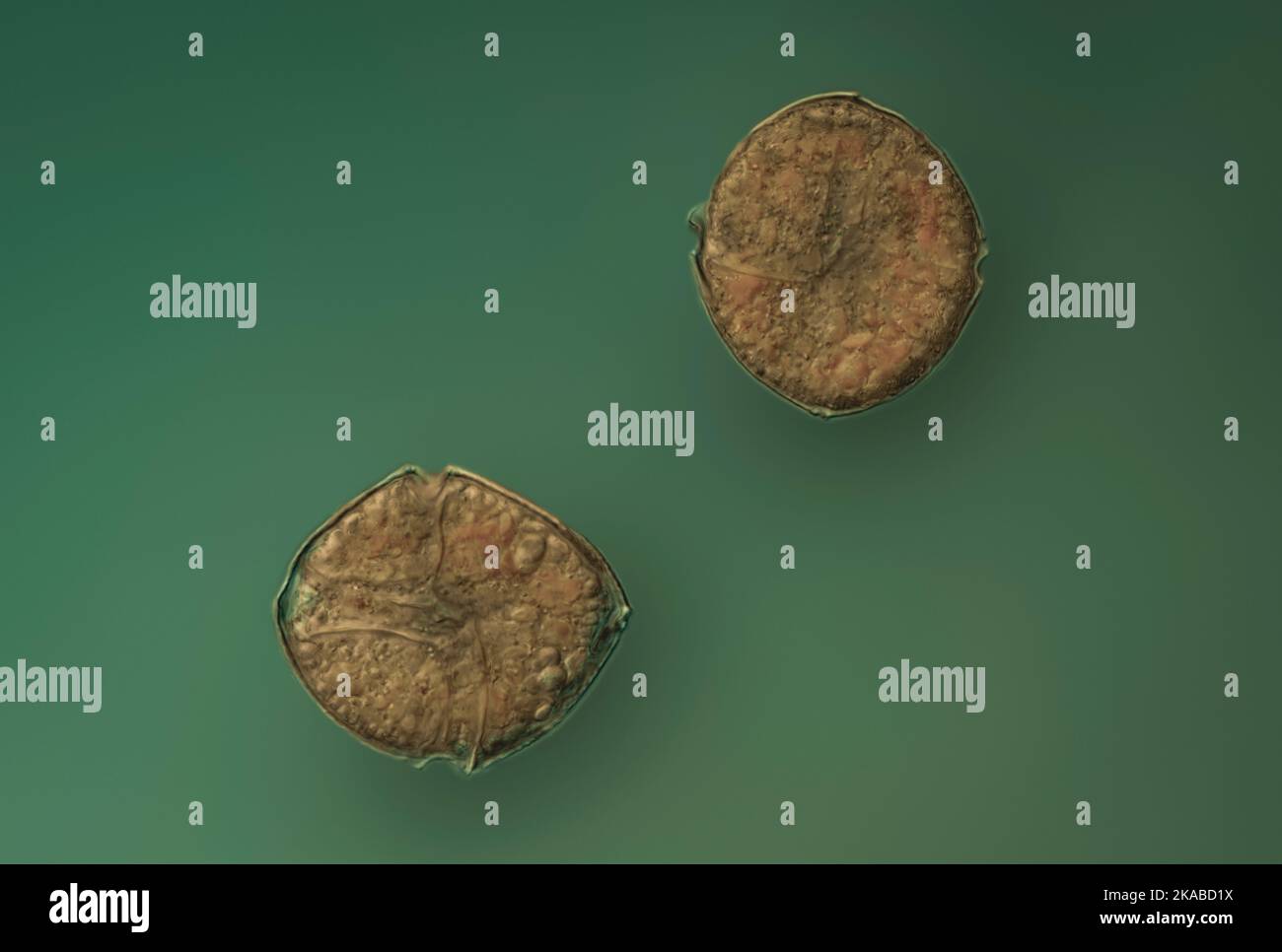 Peridinium sp. Dinoflagellate, light micrograph Stock Photo - Alamy