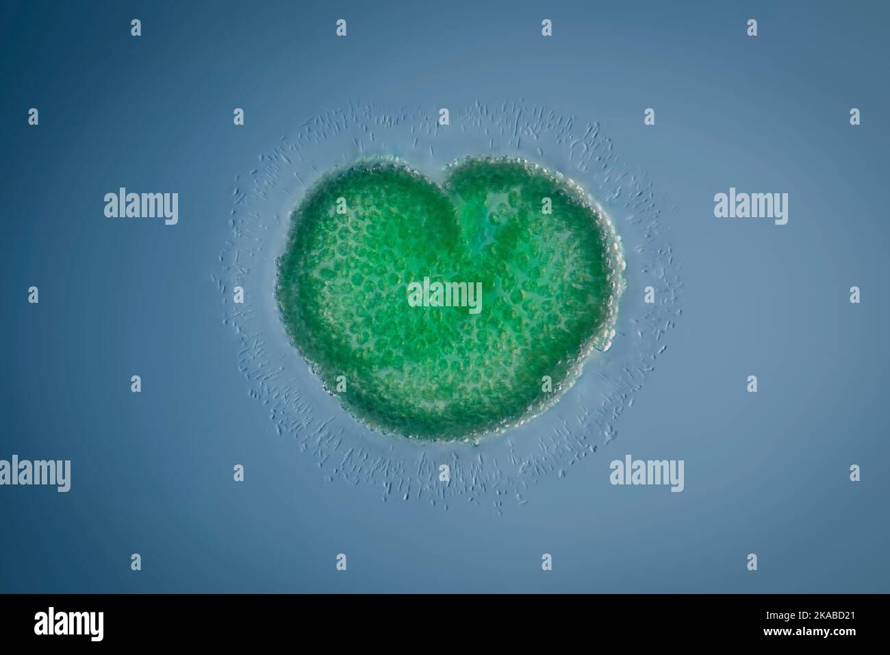 Woronichina naegeliana cyanobacteria, light micrograph Stock Photo - Alamy