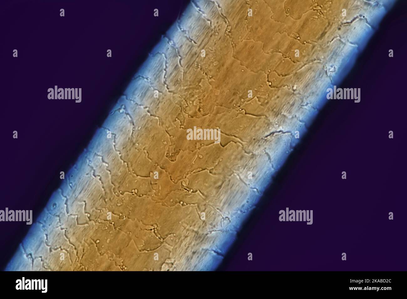 Strand of human hair, light micrograph Stock Photo - Alamy