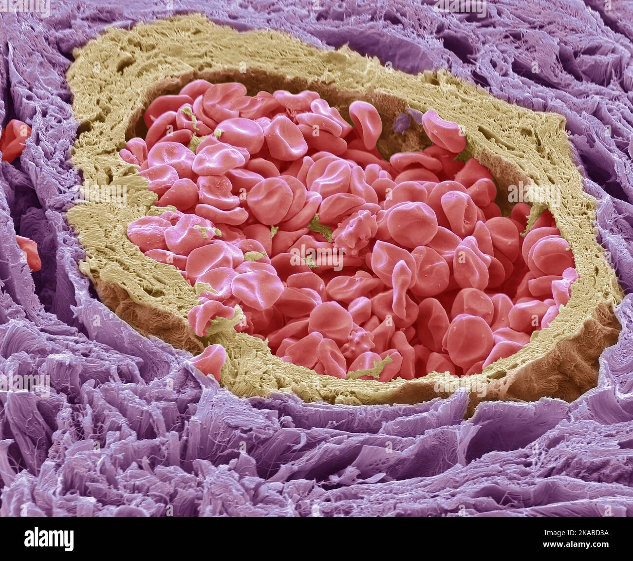 Appendix artery, SEM Stock Photo - Alamy