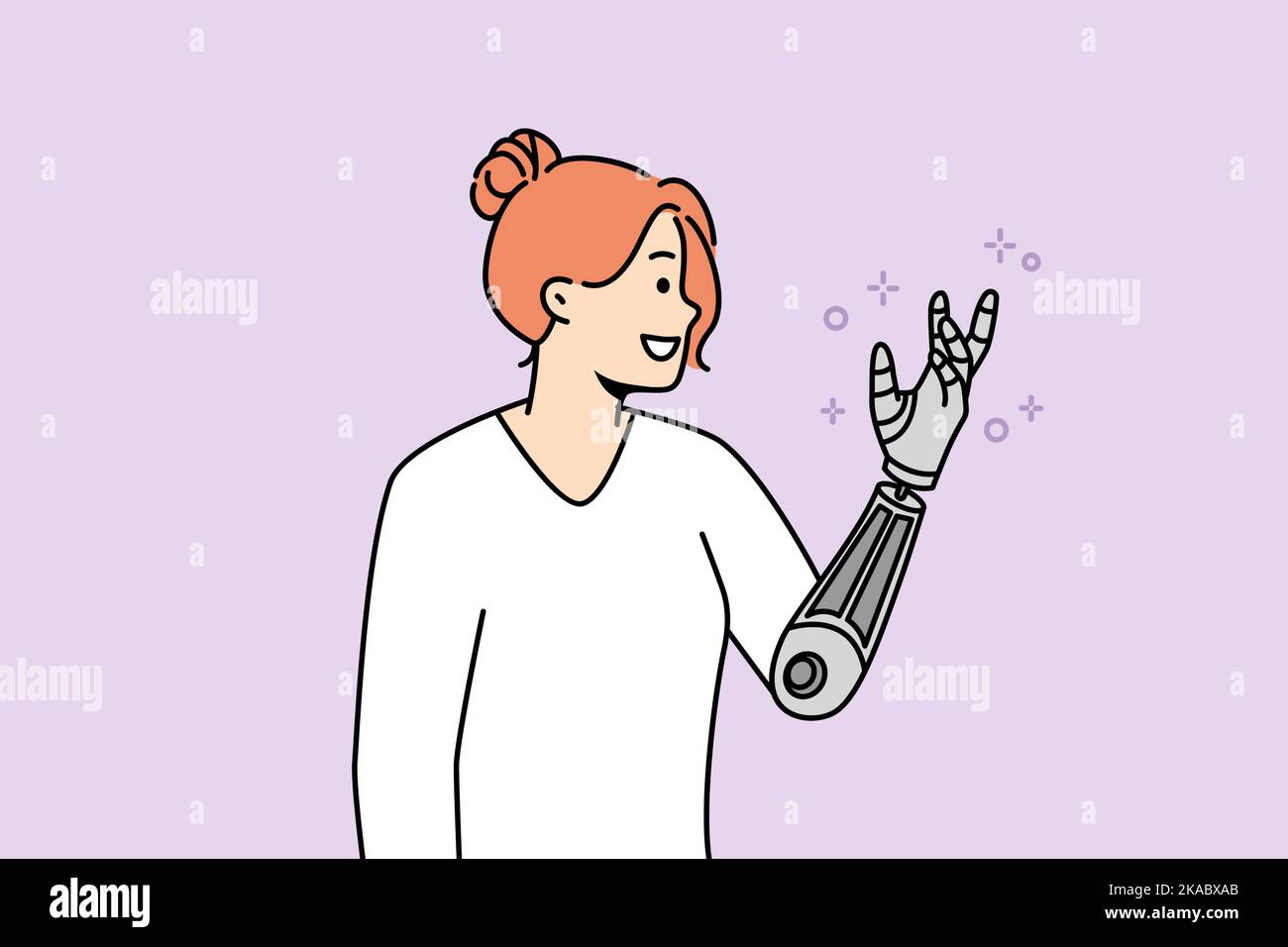 Smiling young woman with bionic arm. Happy female with prosthesis ...