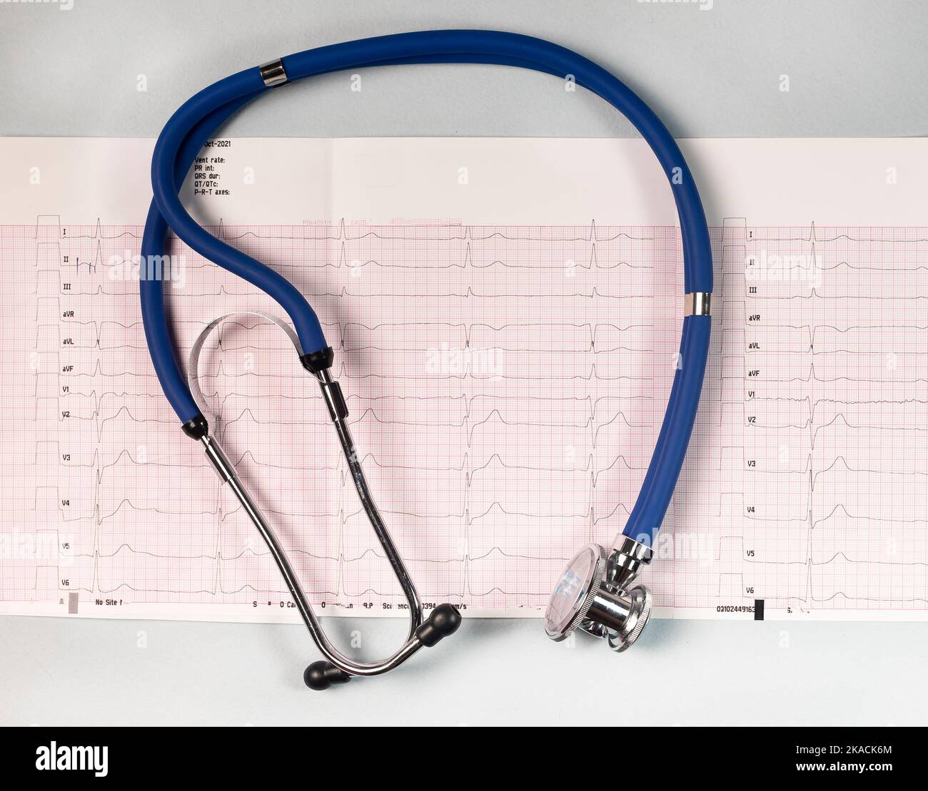 Cardiogram background through magnifying glass, cardiology. ECG and ...