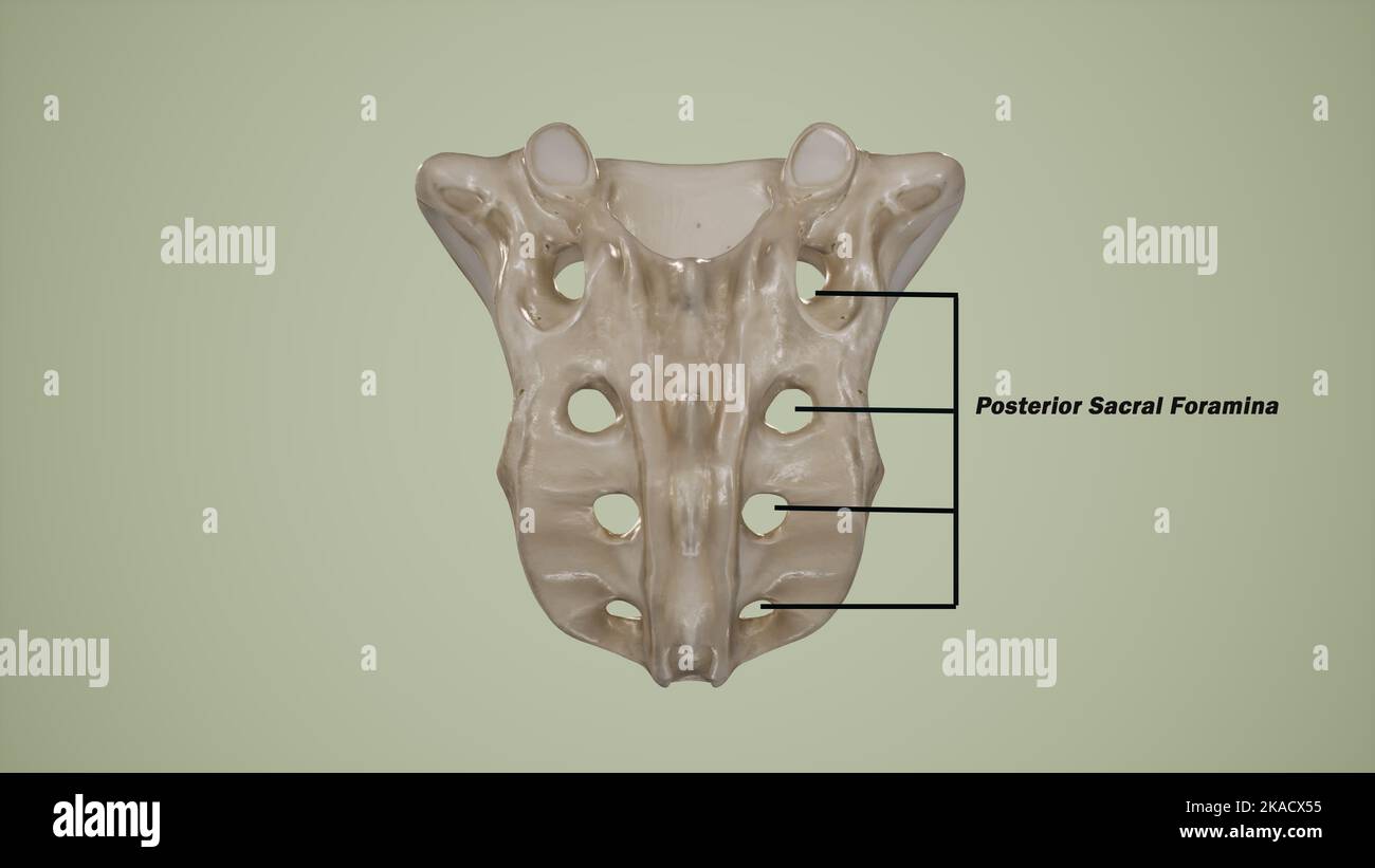 Posterior view of human sacrum showing the posterior sacral foramina ...