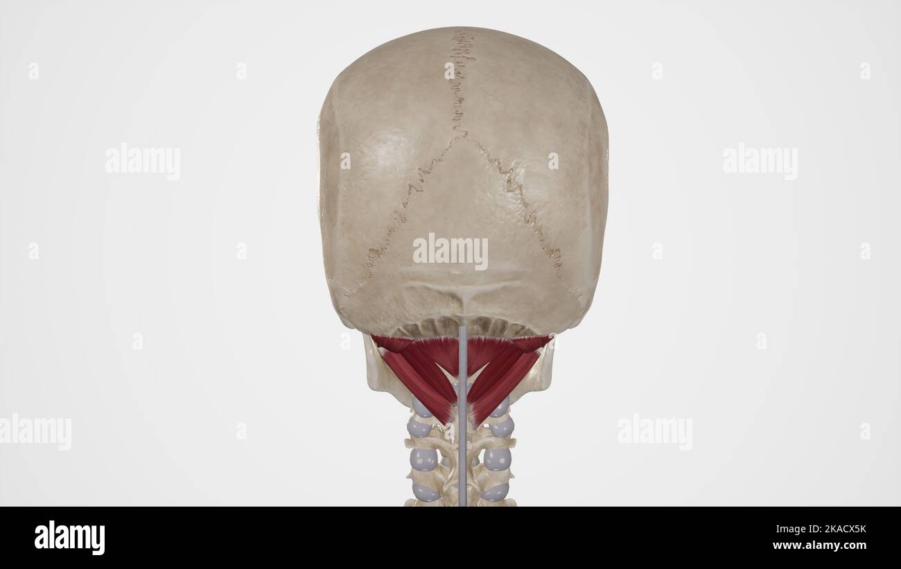 Medical Illustration of Suboccipital Muscles Stock Photo - Alamy
