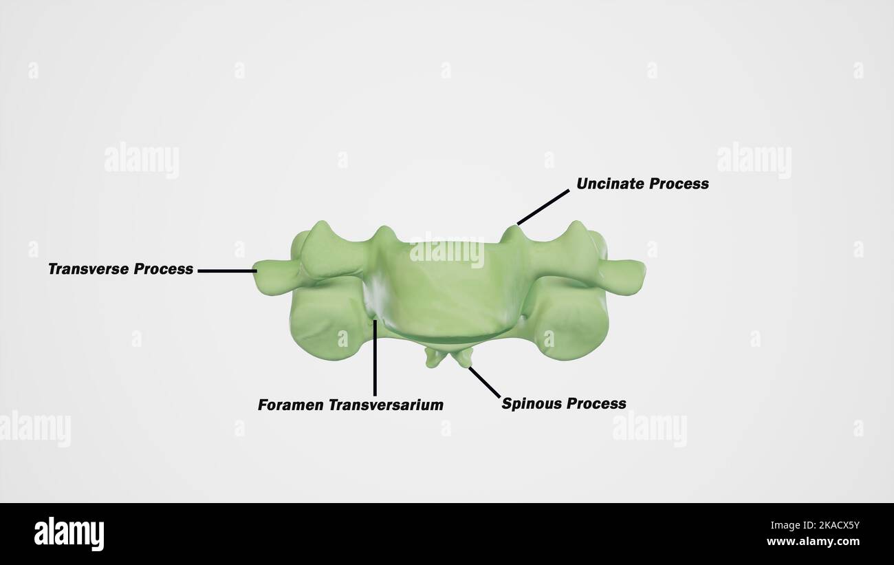 Smaller Uncinate Process
