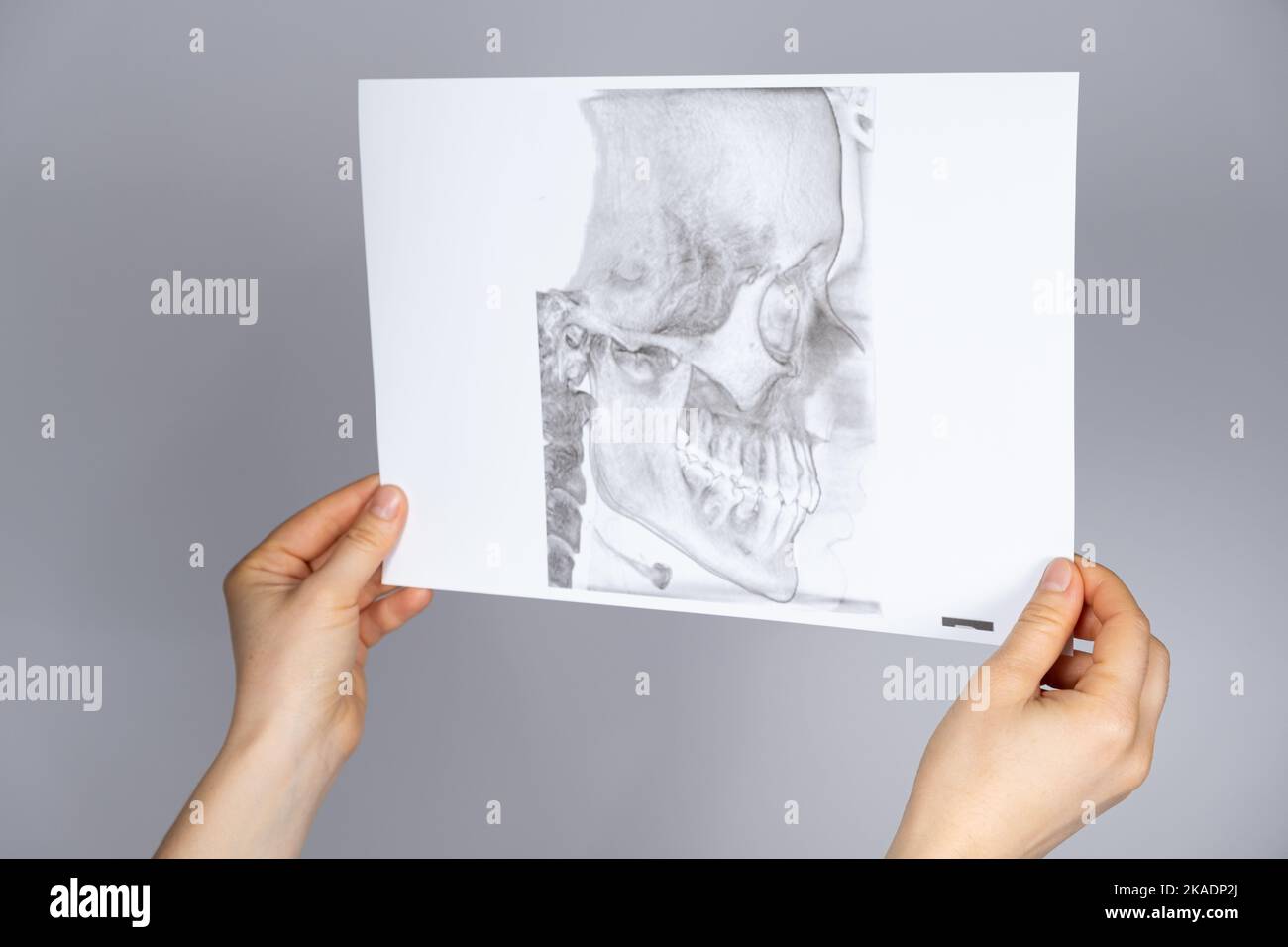 The doctor holds a CT scan of a patient with temporomandibular joint ...