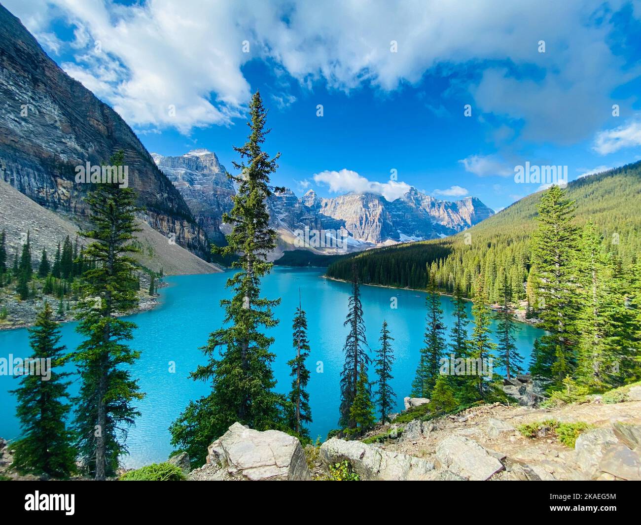 A breathtaking view of Moraine Lake surrounded by lush vegetation and ...