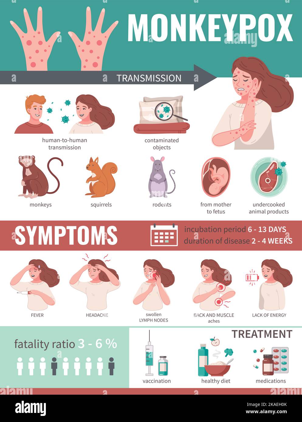 Monkey pox virus infographics with transmission ways and symptoms ...