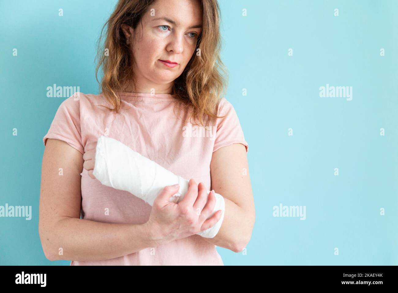 Woman With Broken Arm Fractured Wrist Hand In A Plaster Bandage