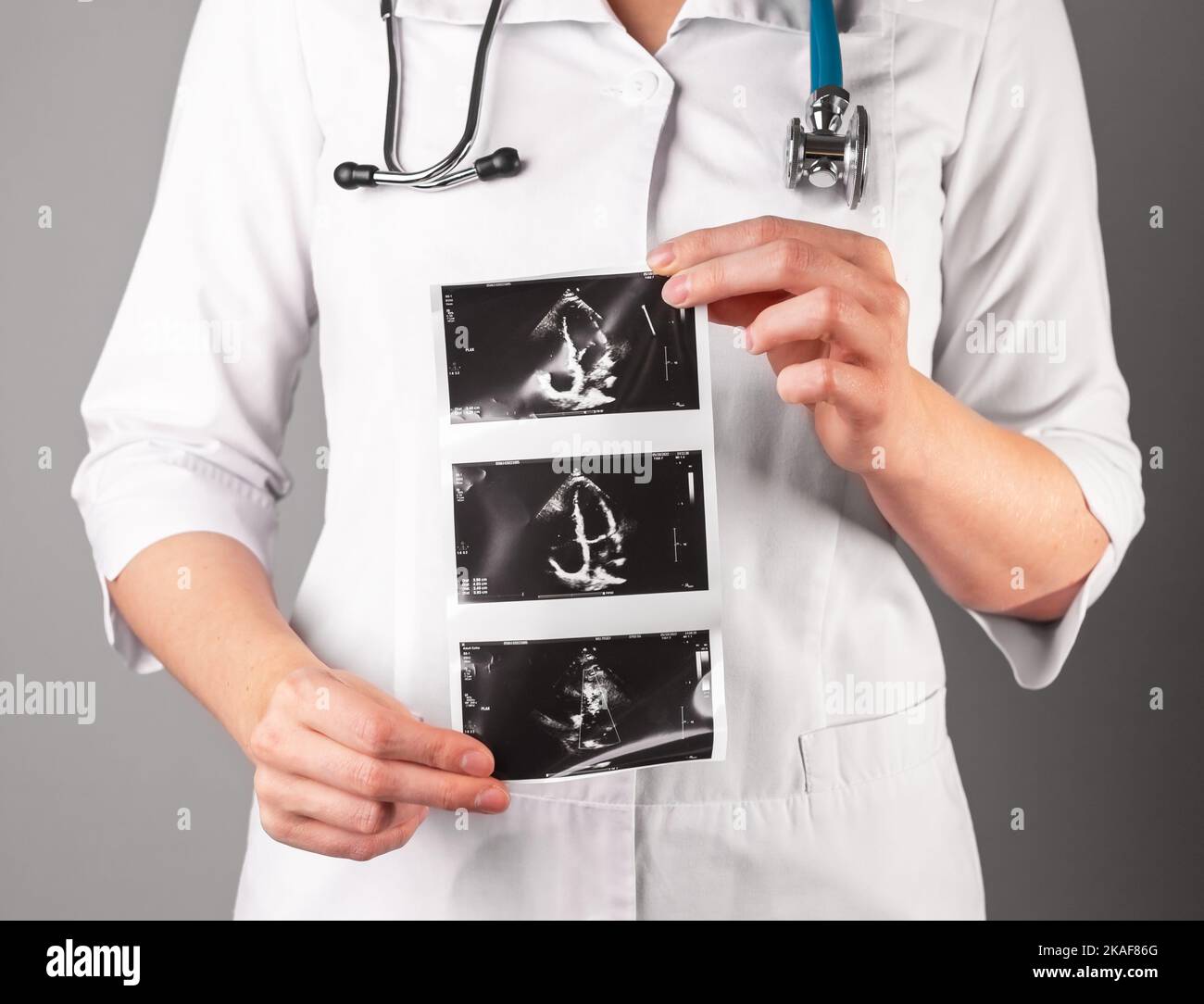 Heart ultrasound, cardiac scan, checkup result. High quality photo ...